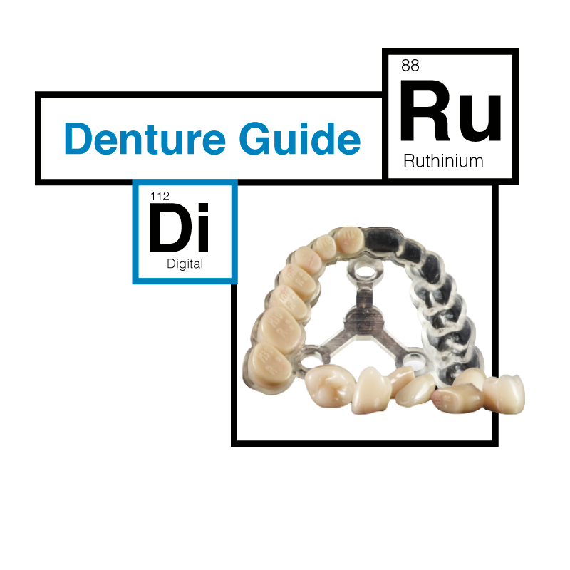 Flusso digitale Ruthinium | 3D Denture Guide
